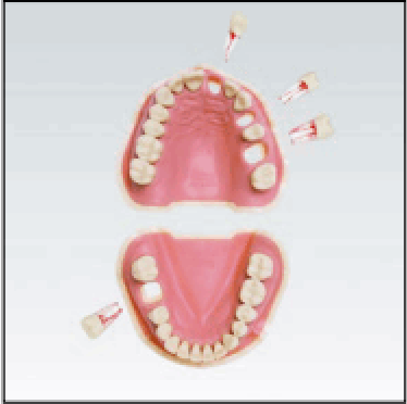Frasaco Endo Modell ANA-4 VEM 901 Ok+Uk - DENTALSPAR AS