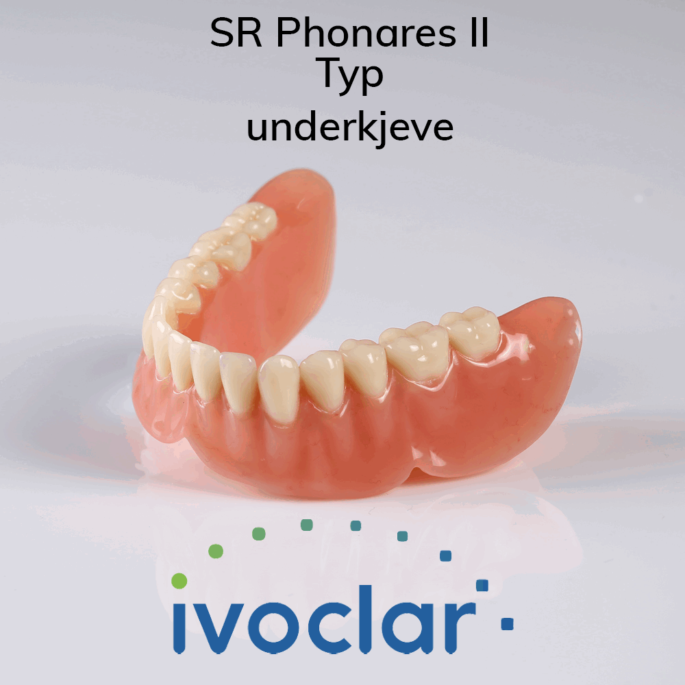 SR Phonares II Typ protesetenner 8 stk UK - DENTALSPAR AS